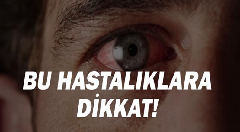 Görme Kaybına Neden Olan Hastalıklara Dikkat! - GÜNDEM - Habere ... Görme Kaybına Neden Olan Hastalıklara Dikkat! - GÜNDEM - Habere ...