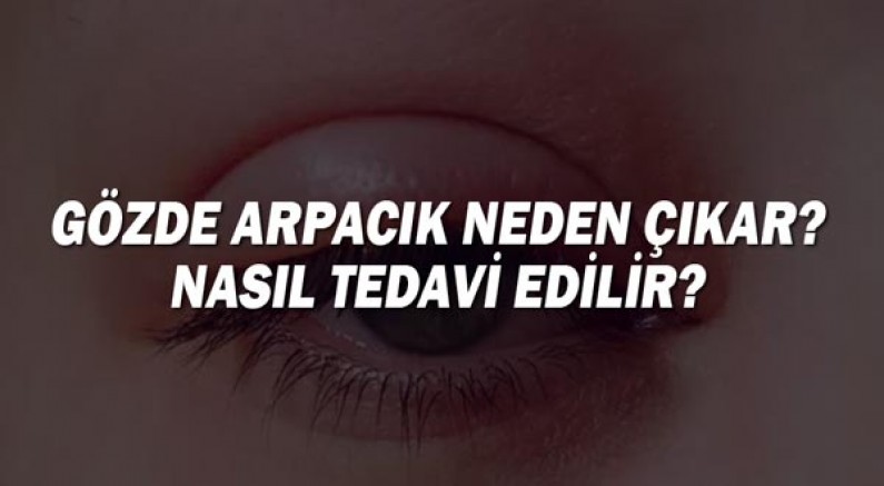 Gözde Arpacık Neden Çıkar? Nasıl Tedavi Edilir? - SAĞLIK - Habere ...